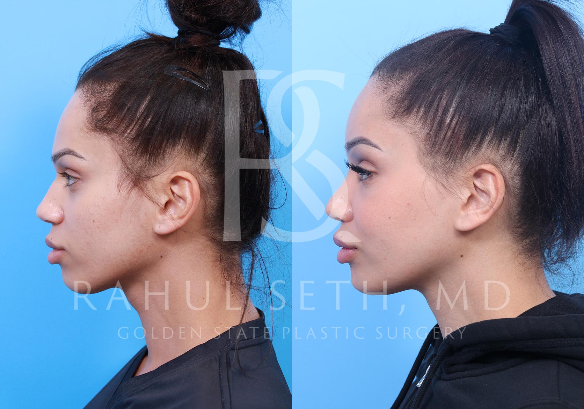 Plastic Surgery | Cosmetics | Golden State Plastic Surgery