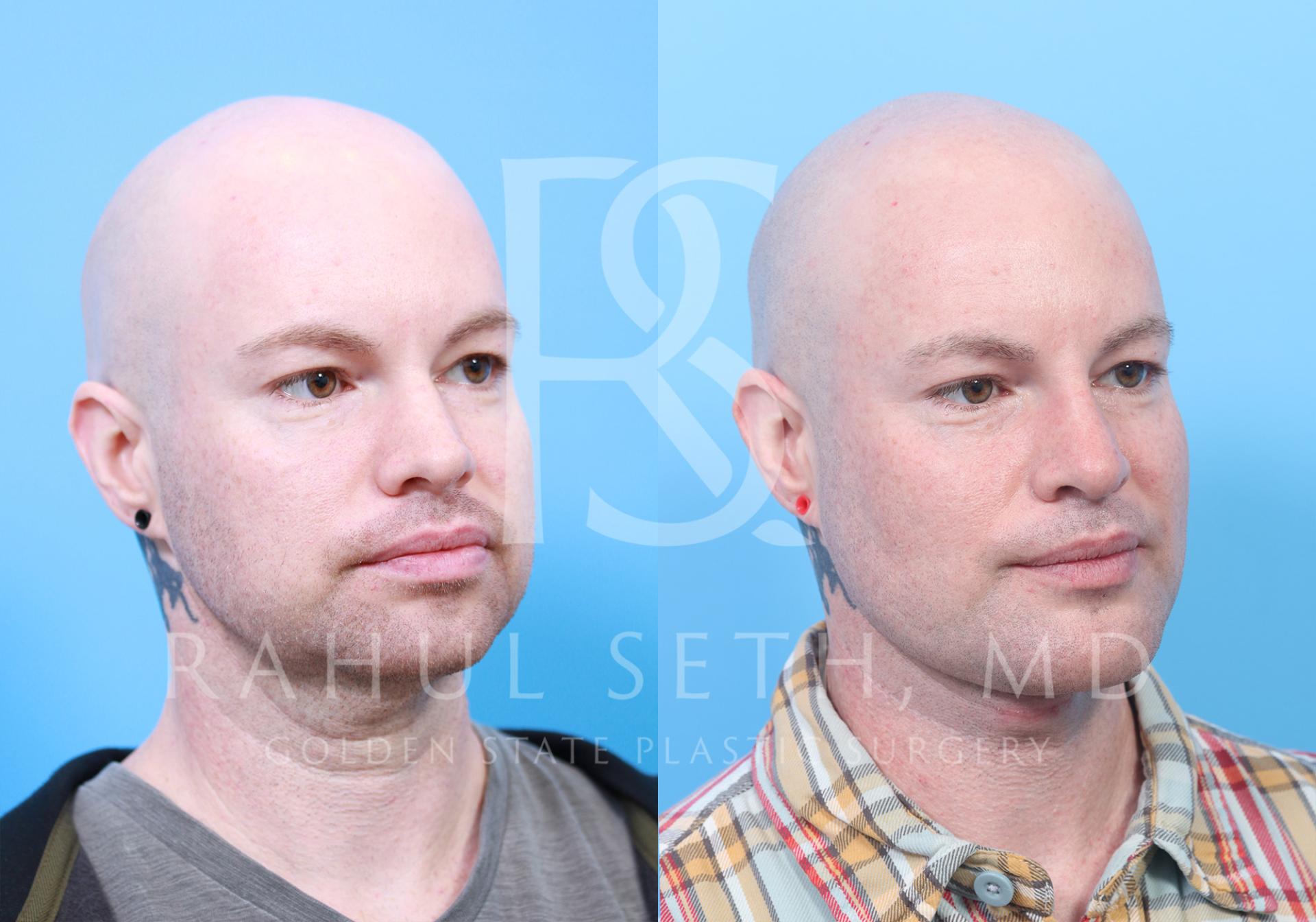 Plastic Surgery | Cosmetics | Golden State Plastic Surgery