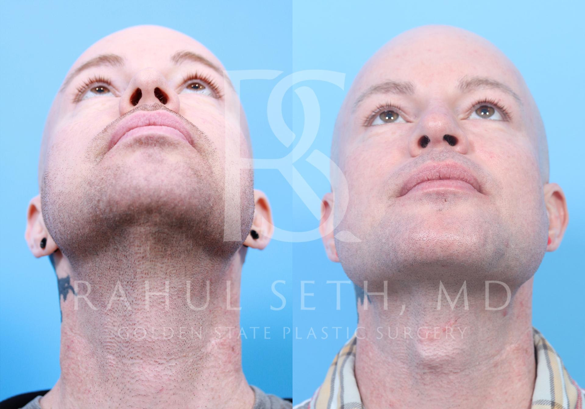 Plastic Surgery | Cosmetics | Golden State Plastic Surgery